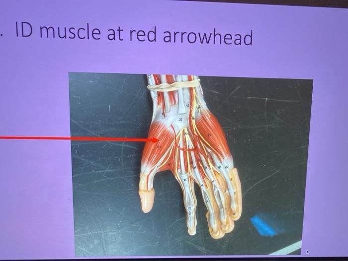 Solved ID muscle at red arrowhead | Chegg.com
