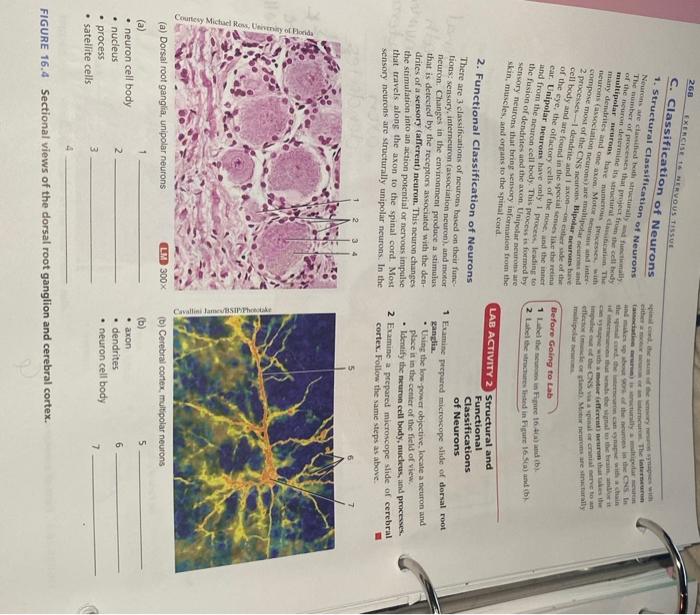 Unipolar Neuron Under Microscope