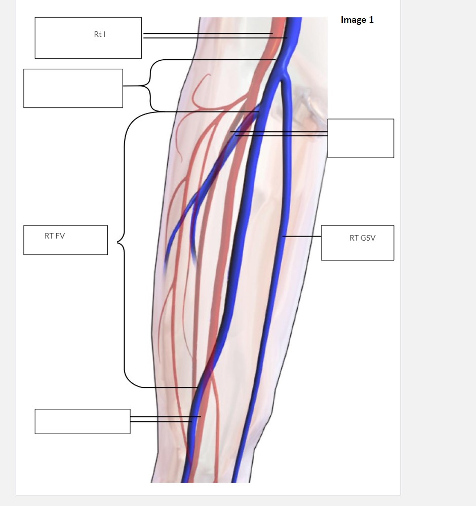 Solved Identify the vessels bilaterally on each image. There | Chegg.com