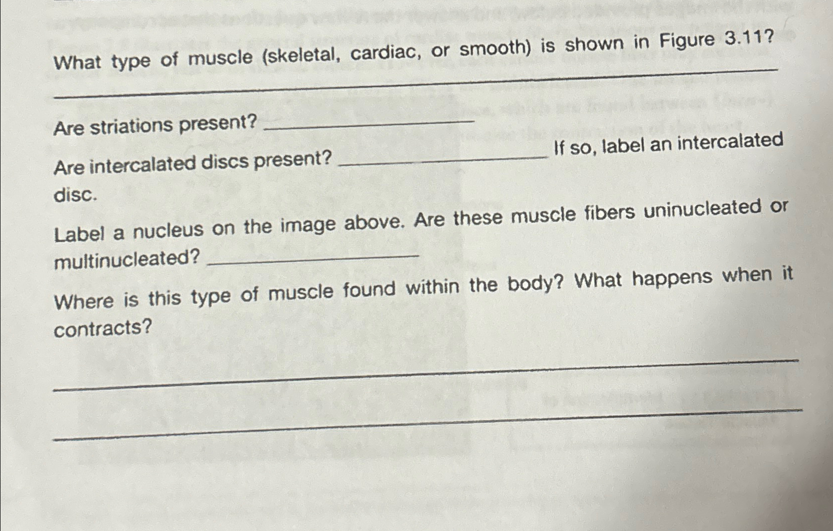Solved What tvpe of muscle (skeletal, ﻿cardiac, or smooth) | Chegg.com
