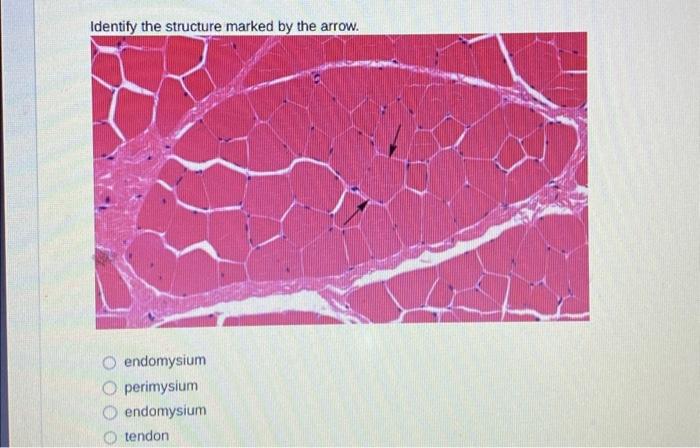 Solved 1.identify the type of muscle found within this | Chegg.com Solved 1.identify the type of muscle found within this | Chegg.com