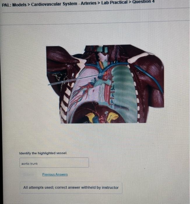 Solved PAL: Models > Cardiovascular System-Arteries > Lab | Chegg.com