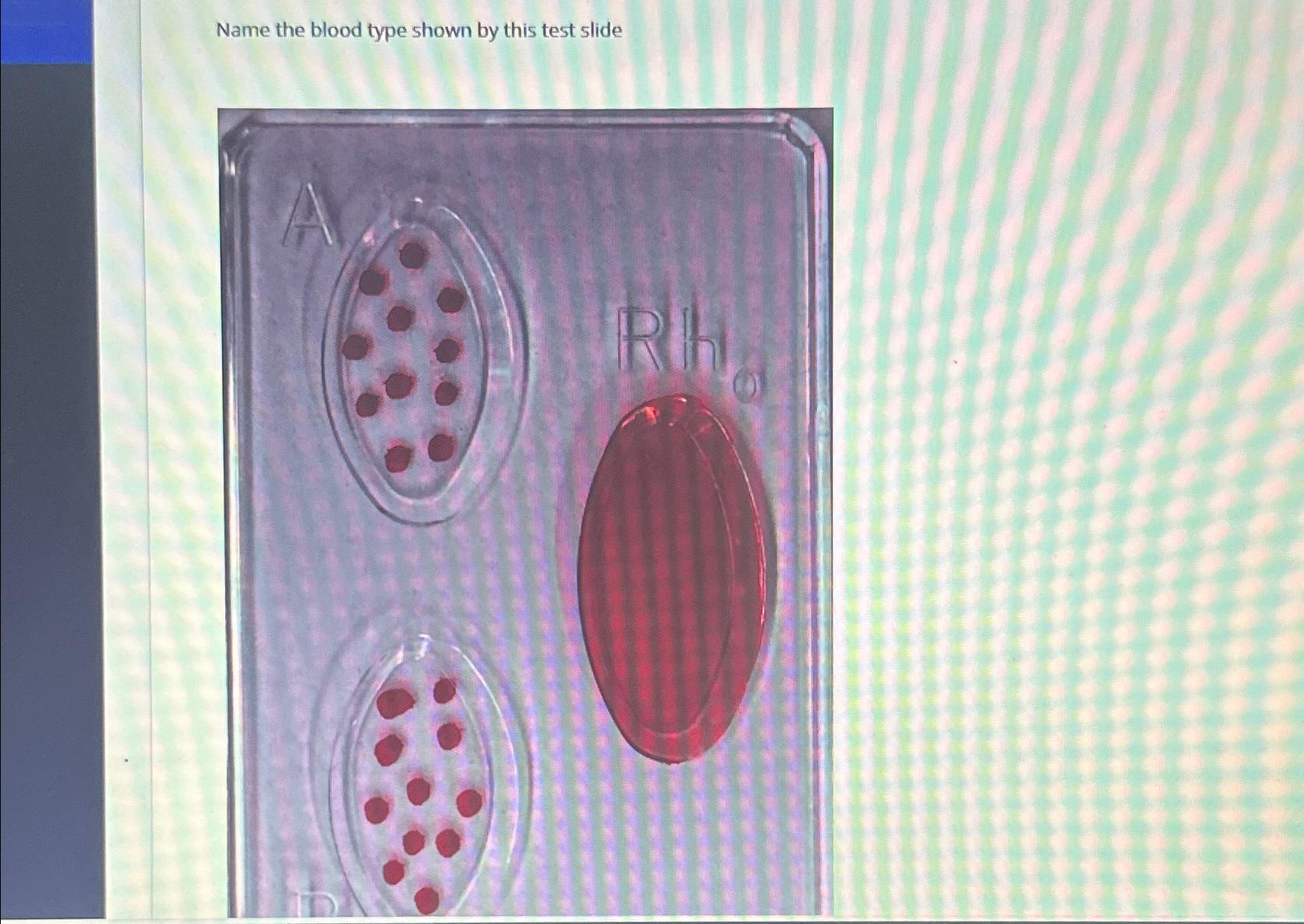 Solved Name the blood type shown by this test slide | Chegg.com