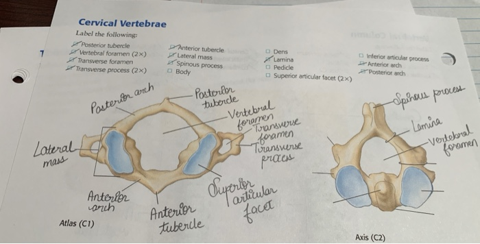 Solved Cervical Vertebrae Label the following: Posterior | Chegg.com