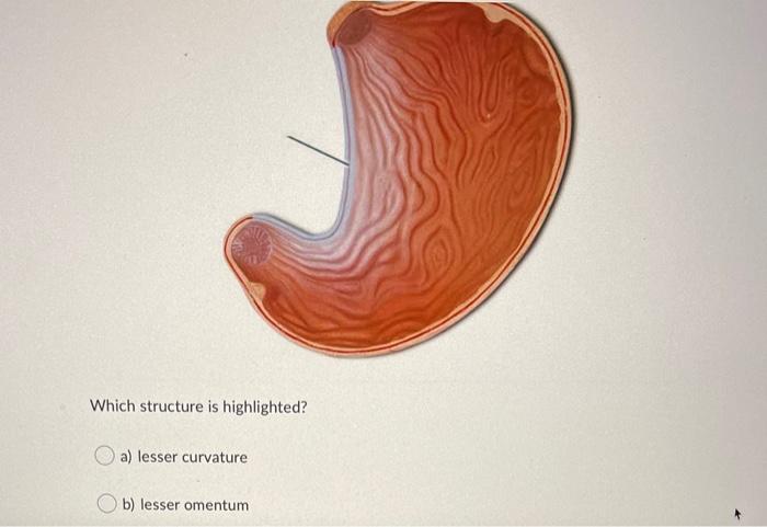 Solved Which structure is highlighted? a) lesser curvature | Chegg.com