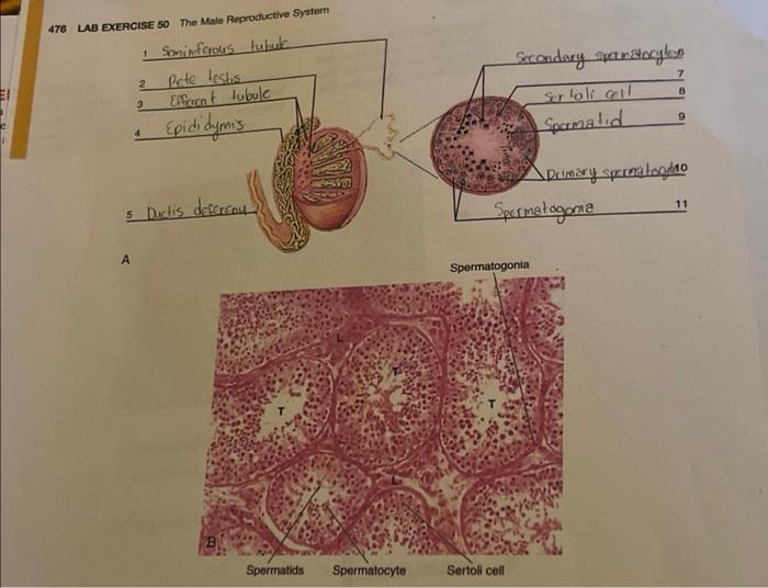 Solved 478 LAB EXERCISE 50 The Male Reproductive System | Chegg.com