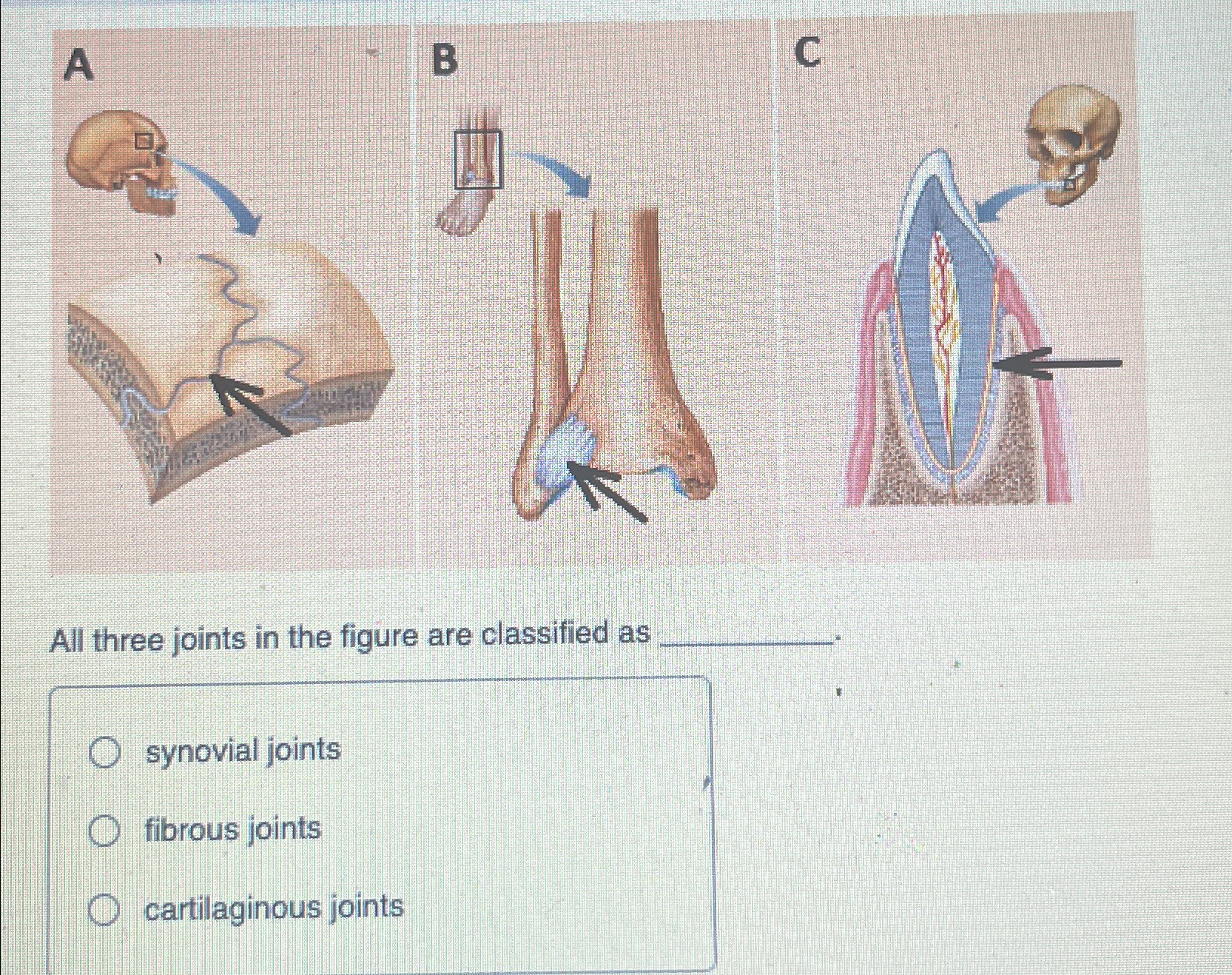 Solved All three joints in the figure are classified as | Chegg.com