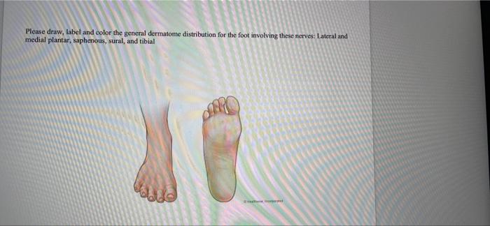 Solved Please draw, label and color the general dermatome | Chegg.com