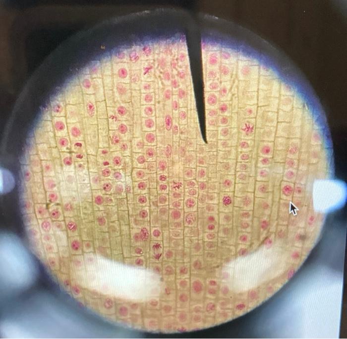 7. Now obtain a slide of Allium Root Tip (Onion) from | Chegg.com