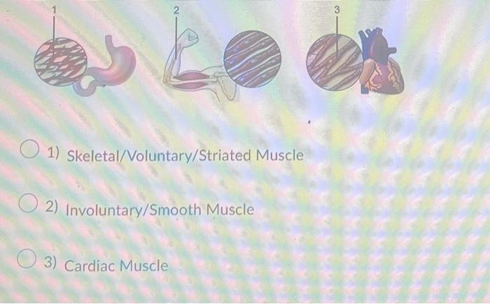 Solved What type of muscle is represented in the image | Chegg.com