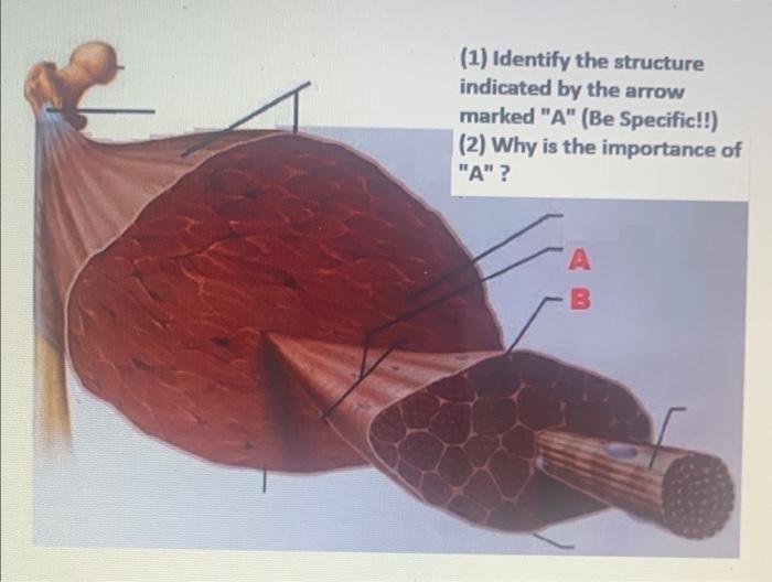 Solved (1) Identify the structure indicated by the arrow | Chegg.com