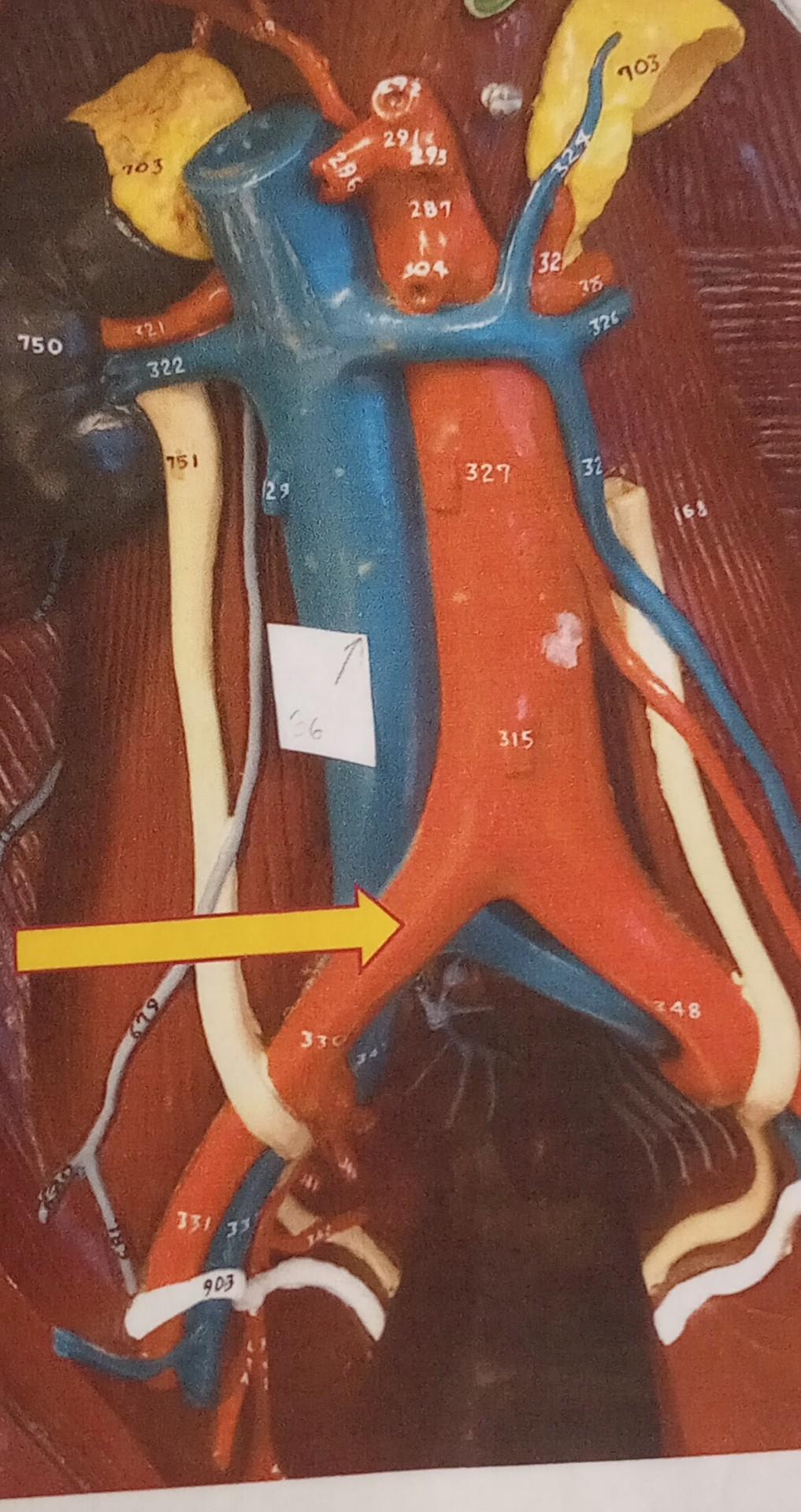 Solved identify the vessel at the arrow | Chegg.com