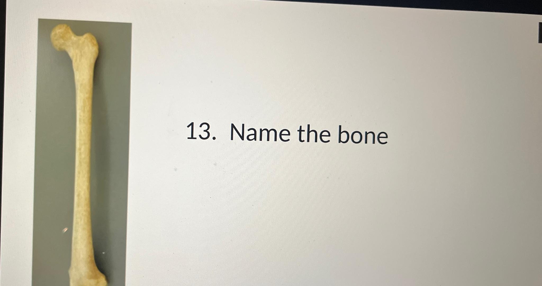 Solved Name the bone | Chegg.com