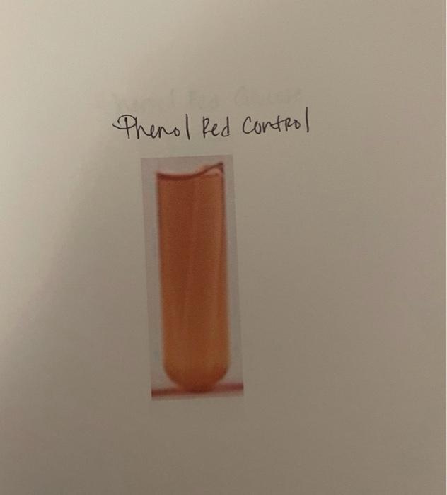 Solved The phenol red broth control Compare to the control | Chegg.com