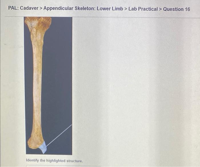 Solved PAL: Cadaver > Appendicular Skeleton: Pelvic Girdle > | Chegg.com