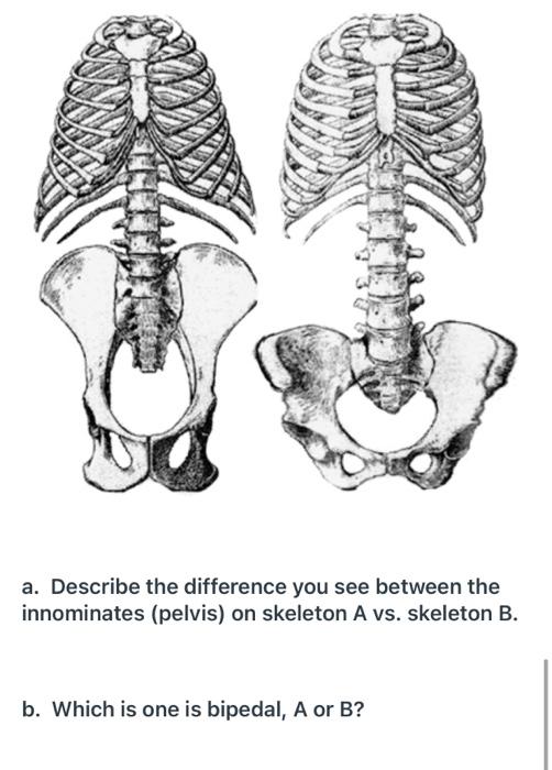 Solved 1. What is the dental formula of mandible A below: | Chegg.com