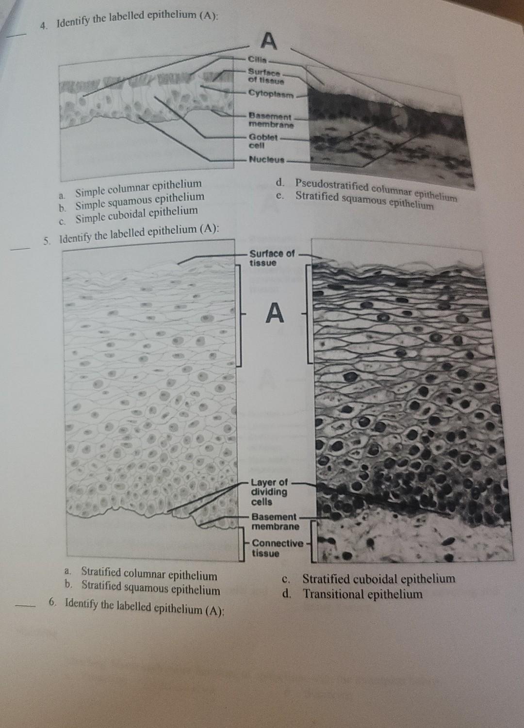Solved 4. Identify the labelled epithelium (A): a. Simple | Chegg.com