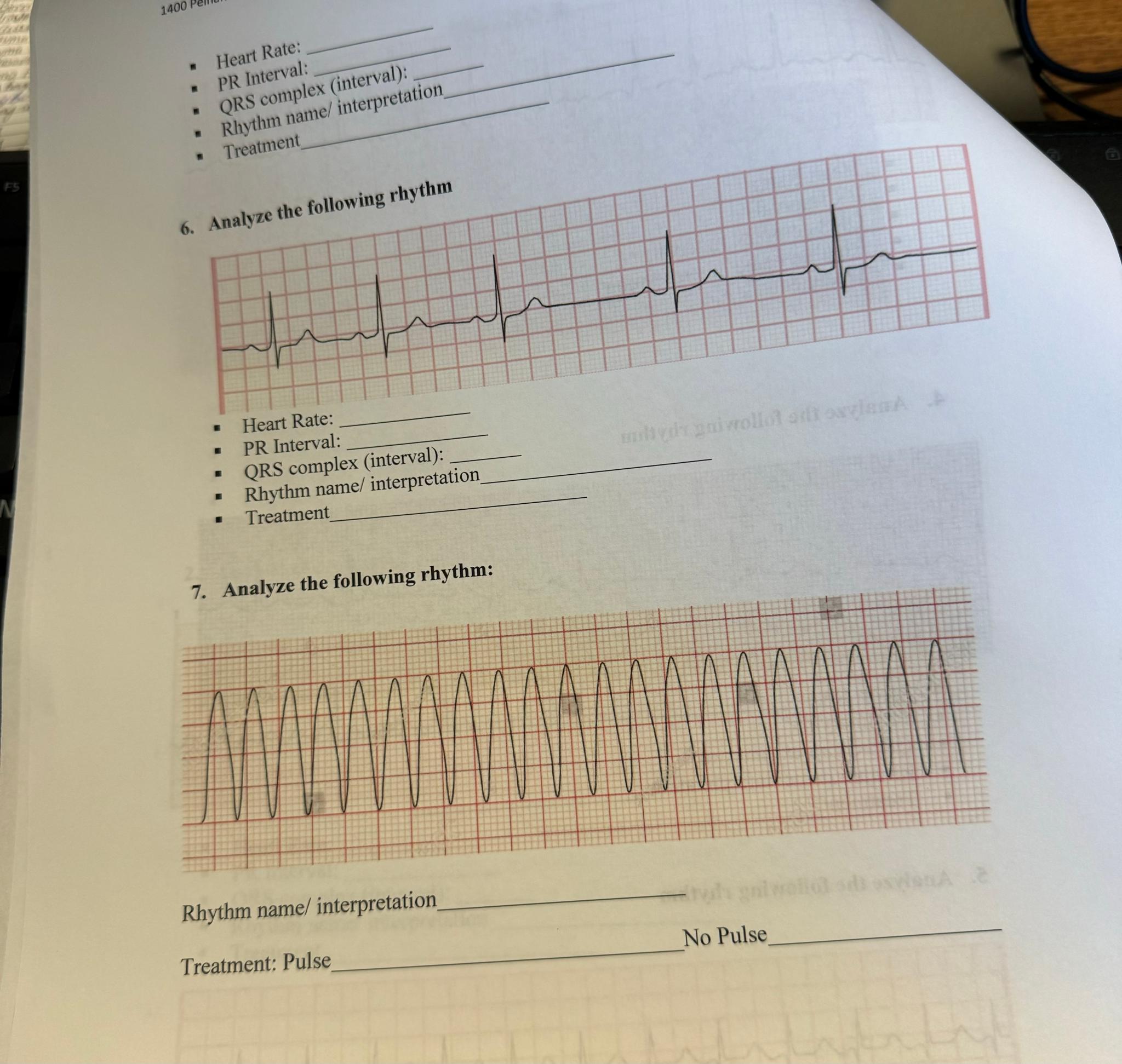 Solved Heart Rate:PR Interval:QRS complex (interval):Rhythm | Chegg.com