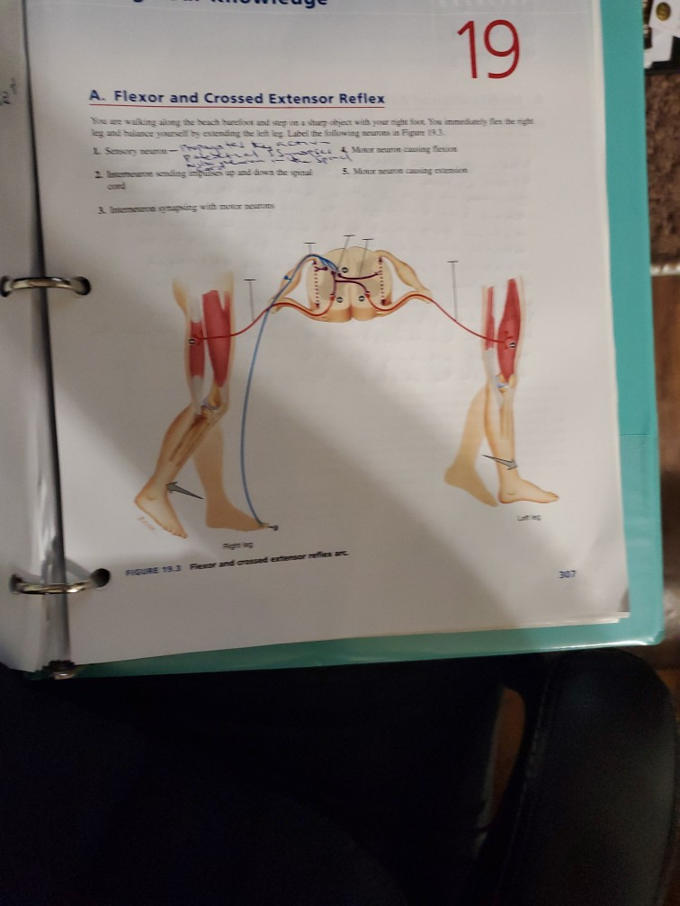 19 A. Flexor and Crossed Extensor Reflex Sing along | Chegg.com