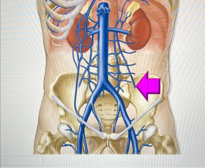 Solved what's the name of the blue vessel? | Chegg.com