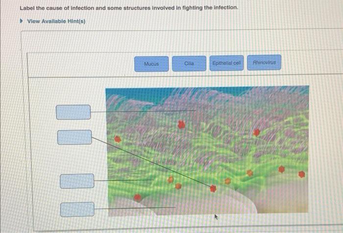 Solved Label the cause of infection and some structures | Chegg.com