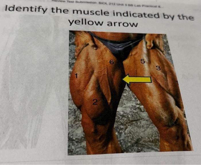 Solved Identify the muscle indicated by the yellow arrow | Chegg.com