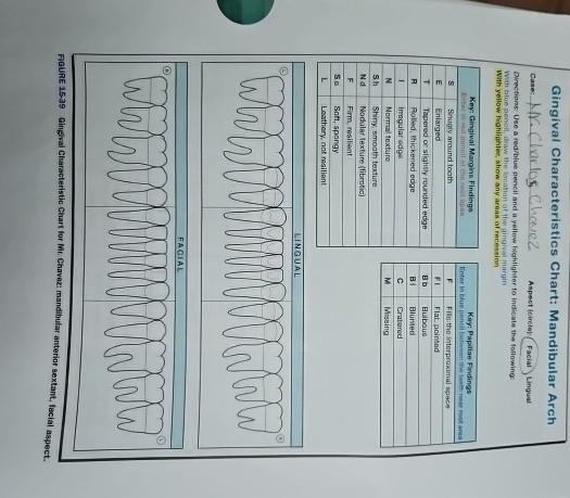 Solved Gingival Characteristics Chart: Mandibular Archcase: | Chegg.com