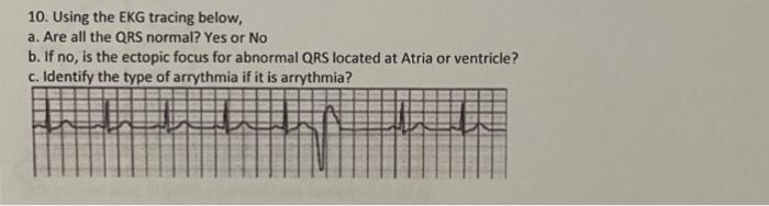 Solved 10. Using the EKG tracing below, a. Are all the QRS | Chegg.com