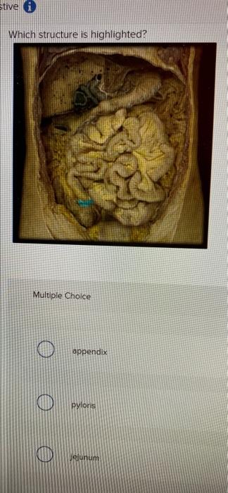 Solved stive Which structure is highlighted? Multiple Choice | Chegg.com