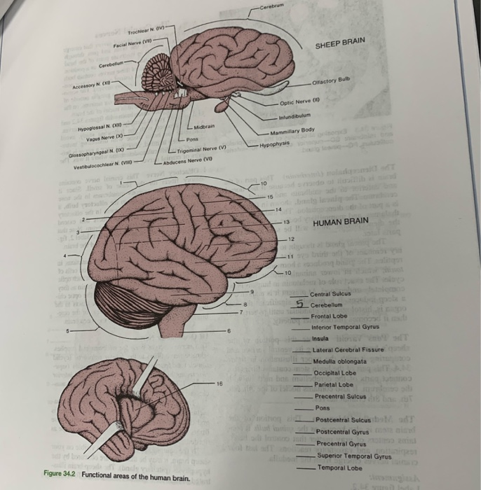 Solved Cerebrum Trochlear Nov Fecial Nerve (V)- SHEEP BRAIN | Chegg.com