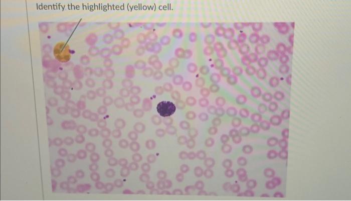 Solved Identify the highlighted (yellow) cell. | Chegg.com