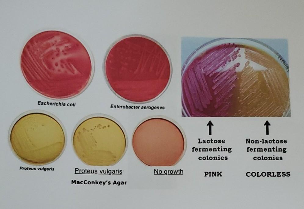 Solved Bacteria of the Gastrointestinal Tract - Enterics | Chegg.com