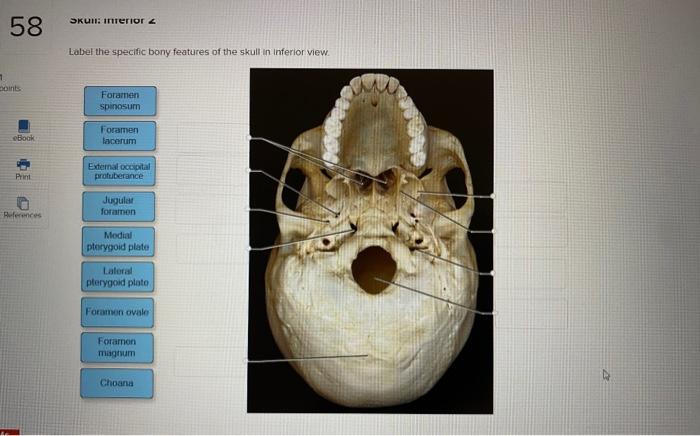 Solved Label the specific bony features of the skull in | Chegg.com