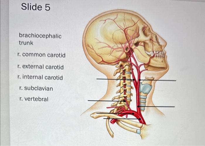 Slide 5 brachiocephalic trunk r. common carotid r. | Chegg.com