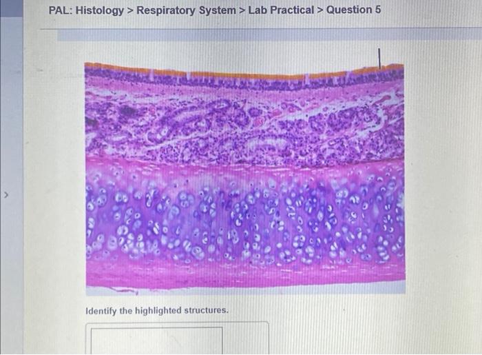 Solved PAL: Histology > Muscular Tissue > Lab Practical > | Chegg.com