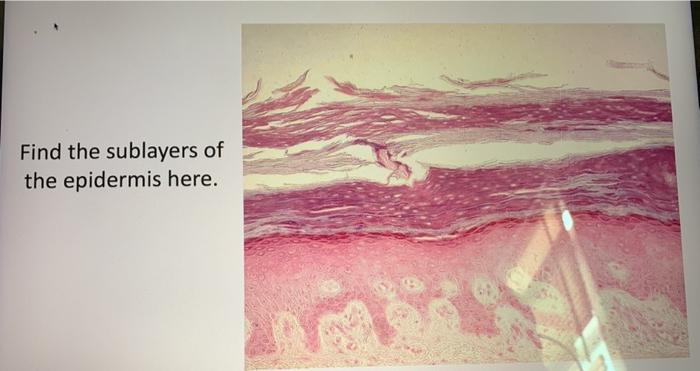 Solved Find the sublayers of the epidermis here. Find the | Chegg.com