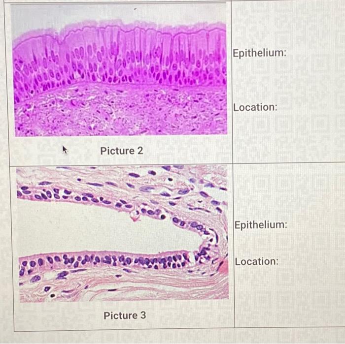 Solved Name the type of epithelium and ONE location example | Chegg.com