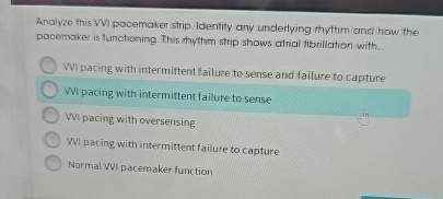 Solved Analyze this WVI pacemaker strip. Identity any | Chegg.com