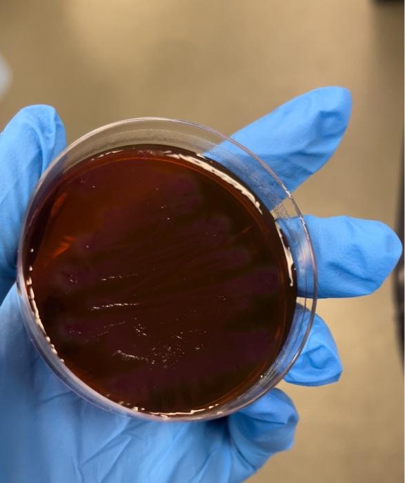 Solved This is an Eosin Methylene Blue (EMB) agar plate. I | Chegg.com