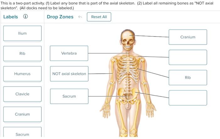 This is a two-part activity. (1) Label any bone that | Chegg.com