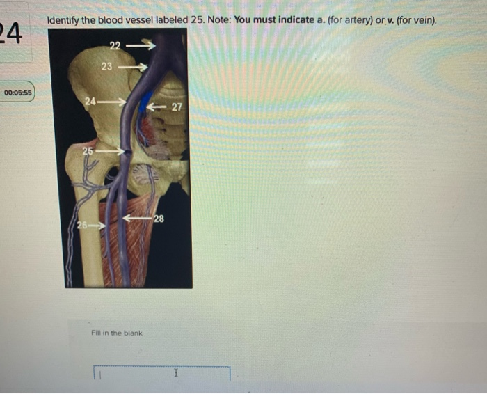 Solved Identify the blood vessel labeled G. Note: You must | Chegg.com