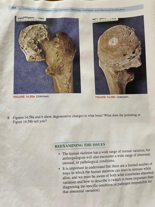 Solved Chapter 14: Abnormalities in the Skeleton Pathology. | Chegg.com