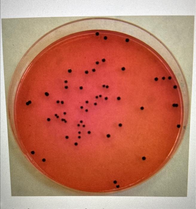 Solved below is XLD agar, describe the results | Chegg.com