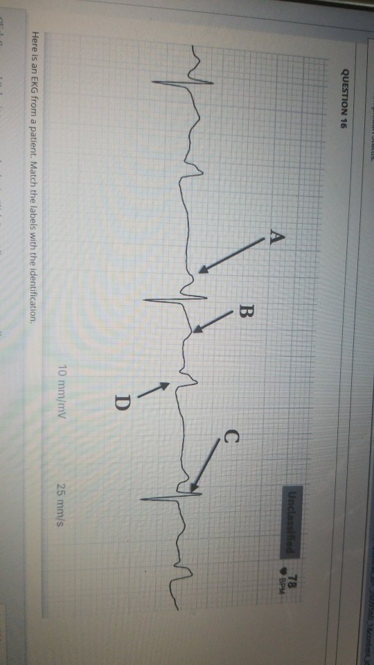 Solved 60content QUESTION 16 Unclassified 78 BPM A B С her D | Chegg.com