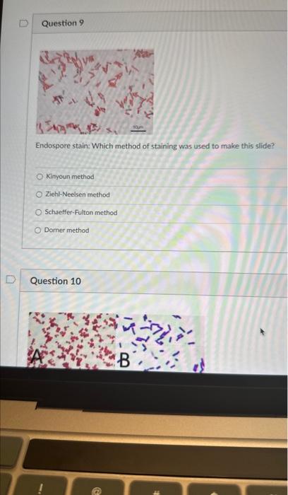 Solved Name the organism (parasite) seen under the | Chegg.com