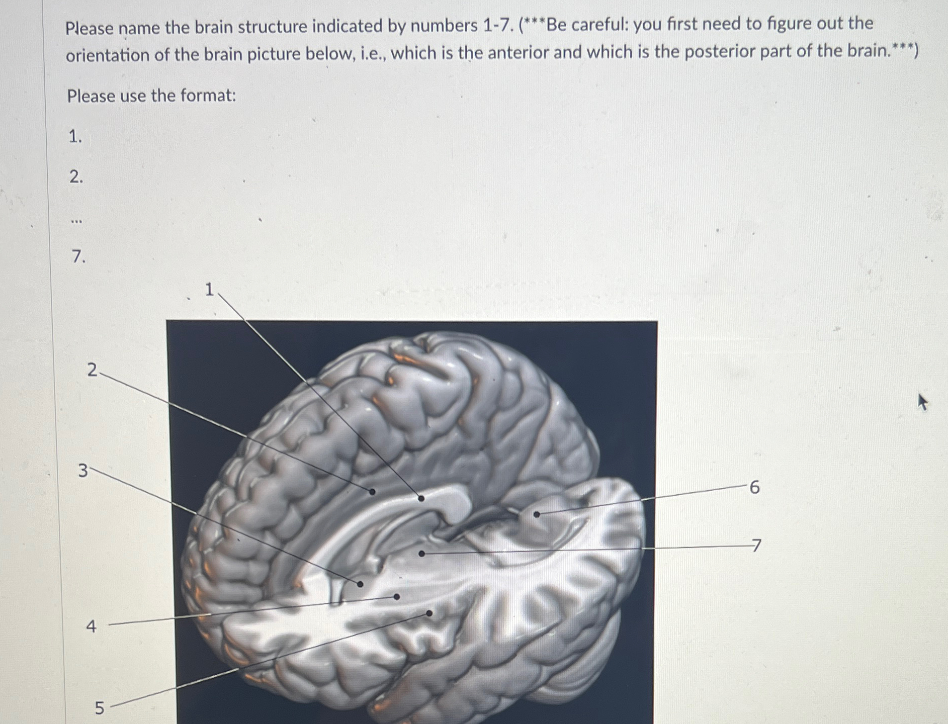 Solved Please name the brain structure indicated by numbers | Chegg.com