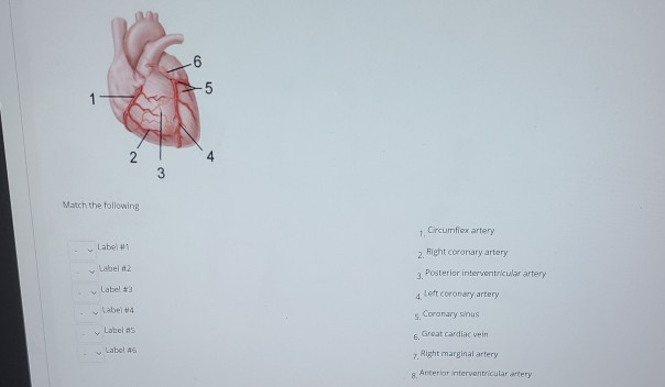 Solved 5 N 3 Match the following 1 Circumflex artery Label | Chegg.com