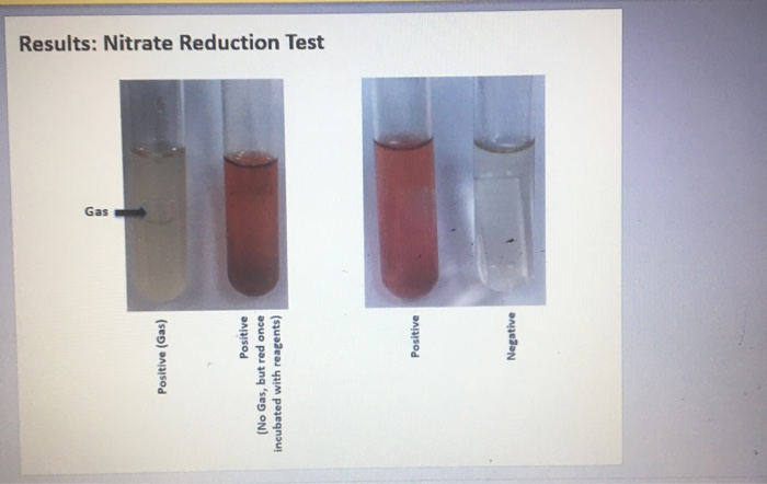 Solved The following biochemical tests were performed: | Chegg.com