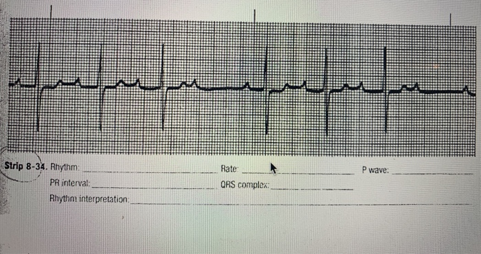 Solved P wave: Strip 8-34. Rhythm PR interval: Rhythm | Chegg.com