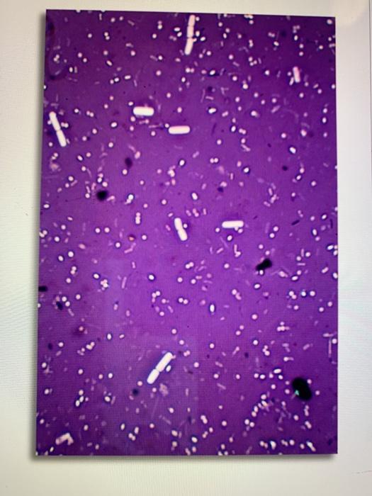 Solved 1. Is this an example of a positive stain or a | Chegg.com